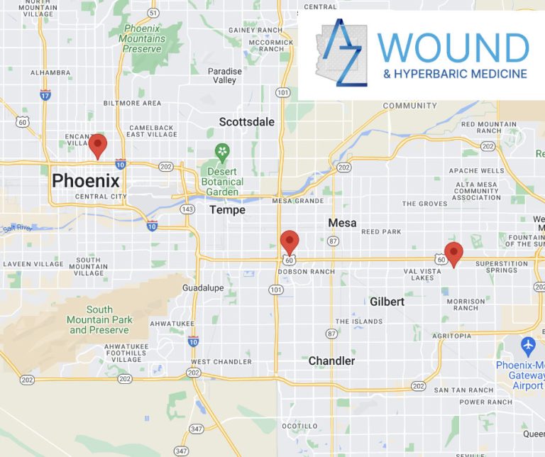 Wound Care Resources & Blog - AZ Wound